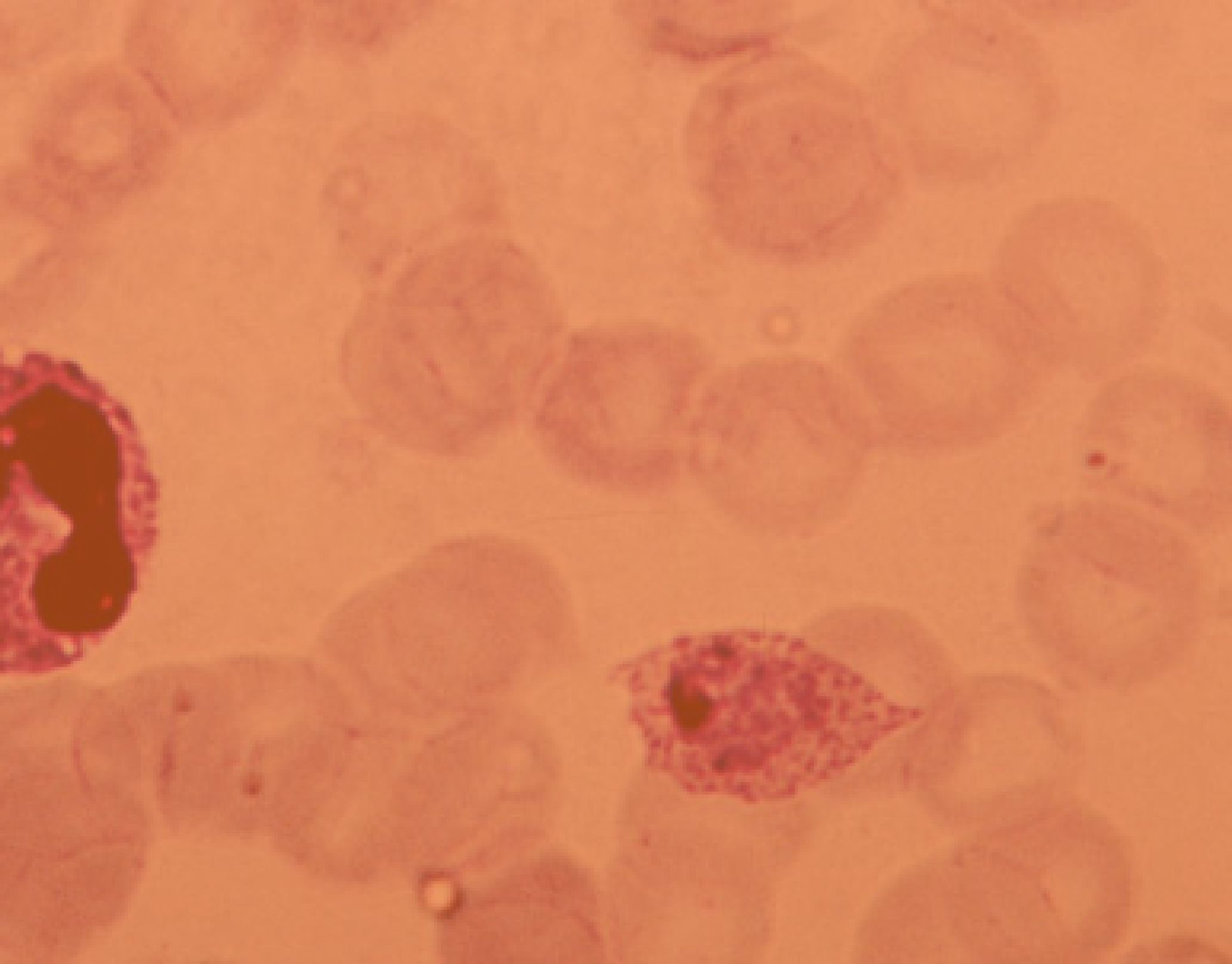 ITHE • Therapeutic Innovation - UMR Merit 261